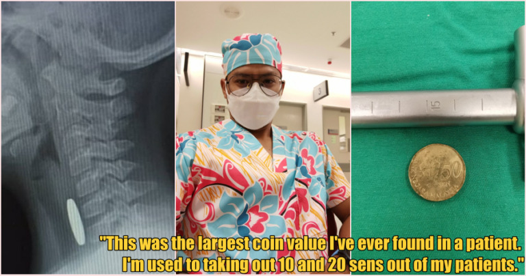 Doctor Urges Parents to be More Aware of Their Kids After Treating a ...